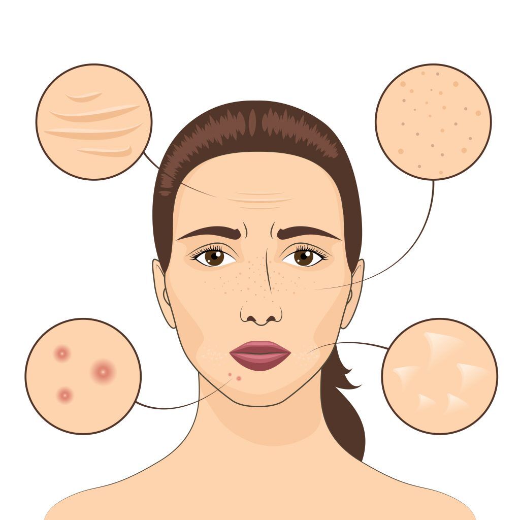Facial Aging Explained. The Top 8 Aging Changes Proven By Researches ...