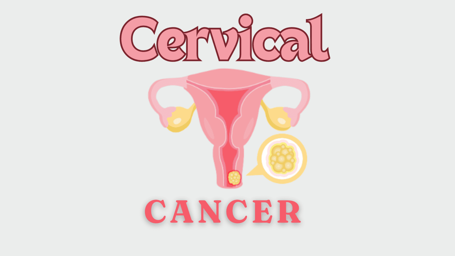 Understanding Cervical Cancer. An informative Guide for Risk Factors ...